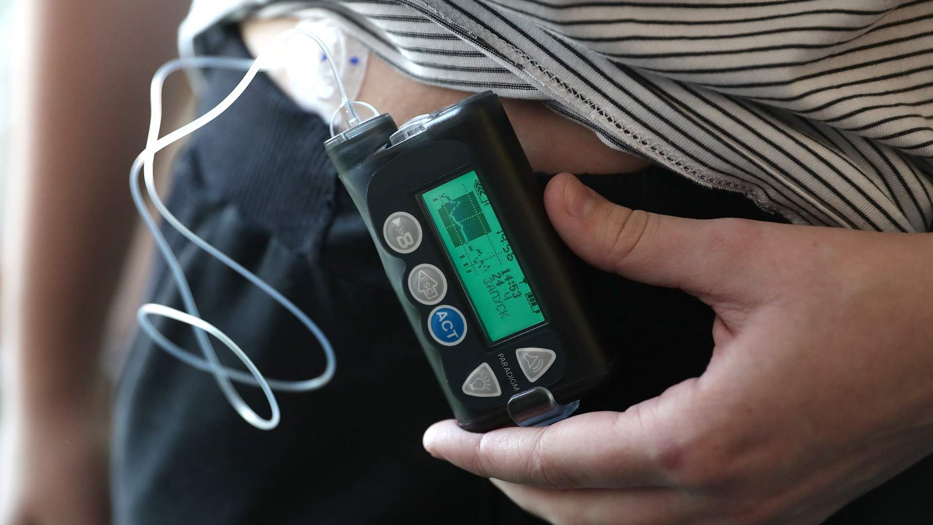 A hard life: parents of children with diabetes ask to be allowed to ...