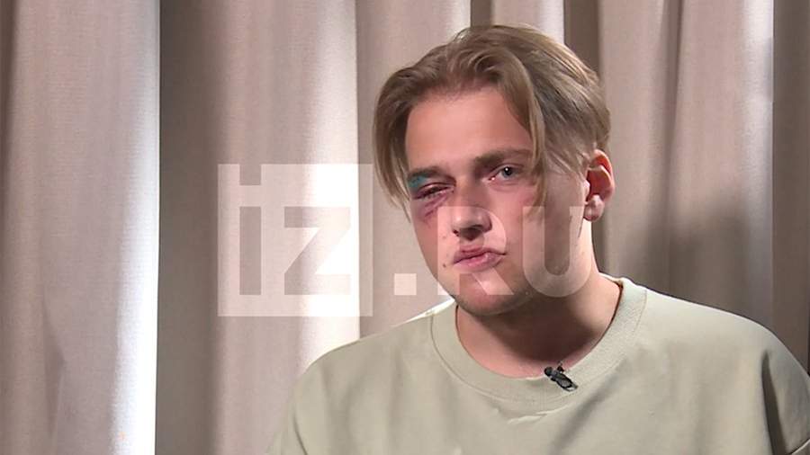 Избитый саунд-продюсер Тимы Белорусских раскрыл подробности нападения ...